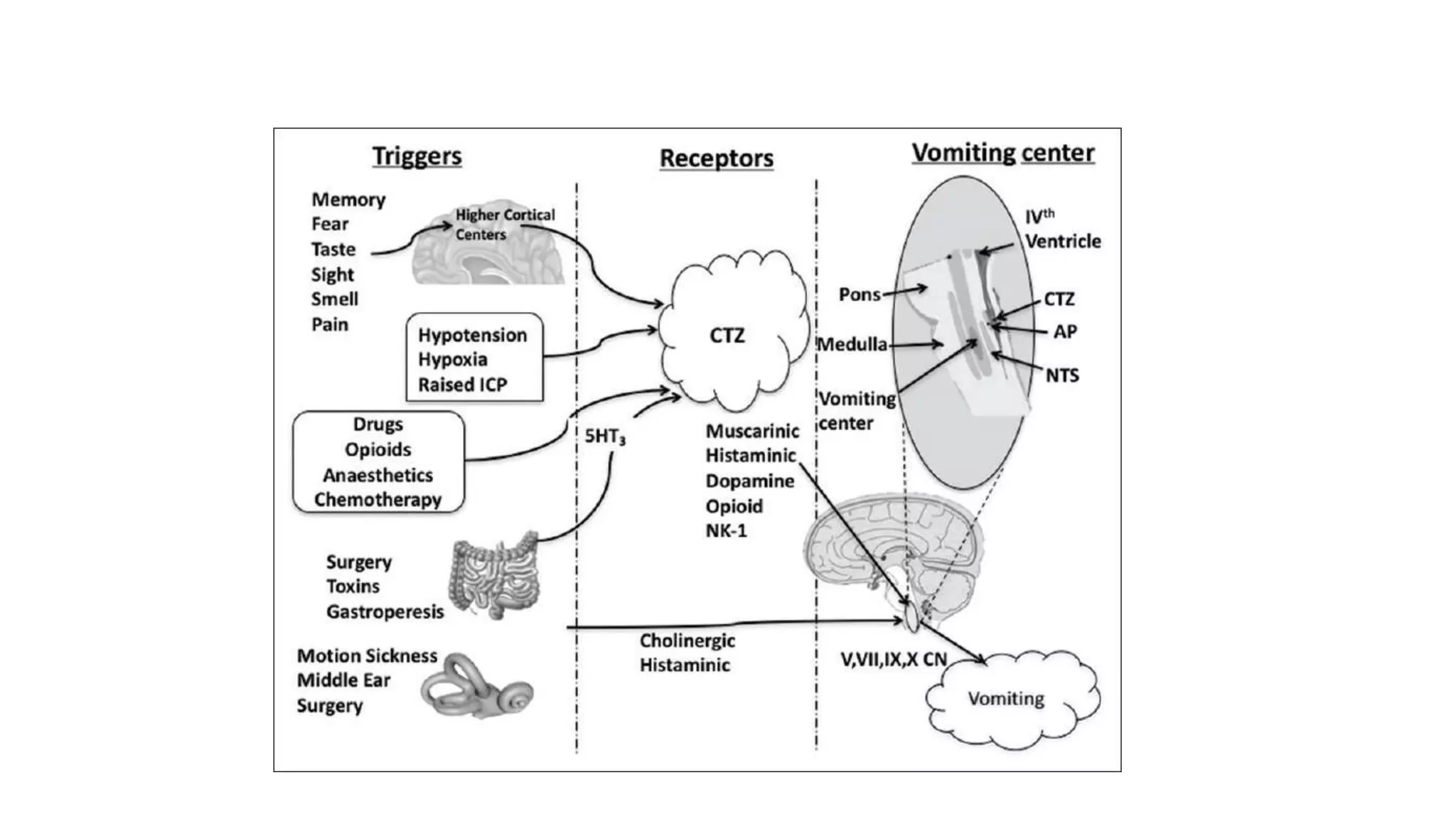 Post operative nausea and vomiting.pptx