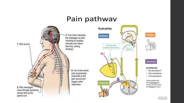 Postoperative pain management | PPT