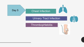 Postoperative pyrexia | PPT