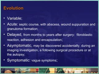 Postoperative retained foreign bodies | PDF | Digestive Disorders ...