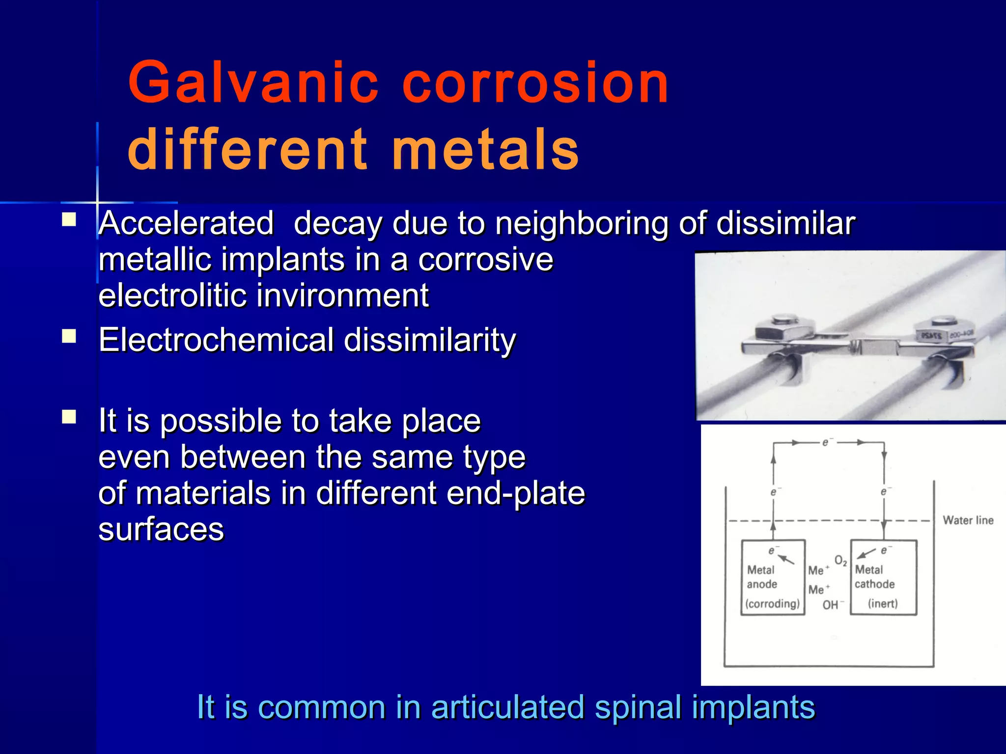 Late Post-operative Spinal Infections | PPT