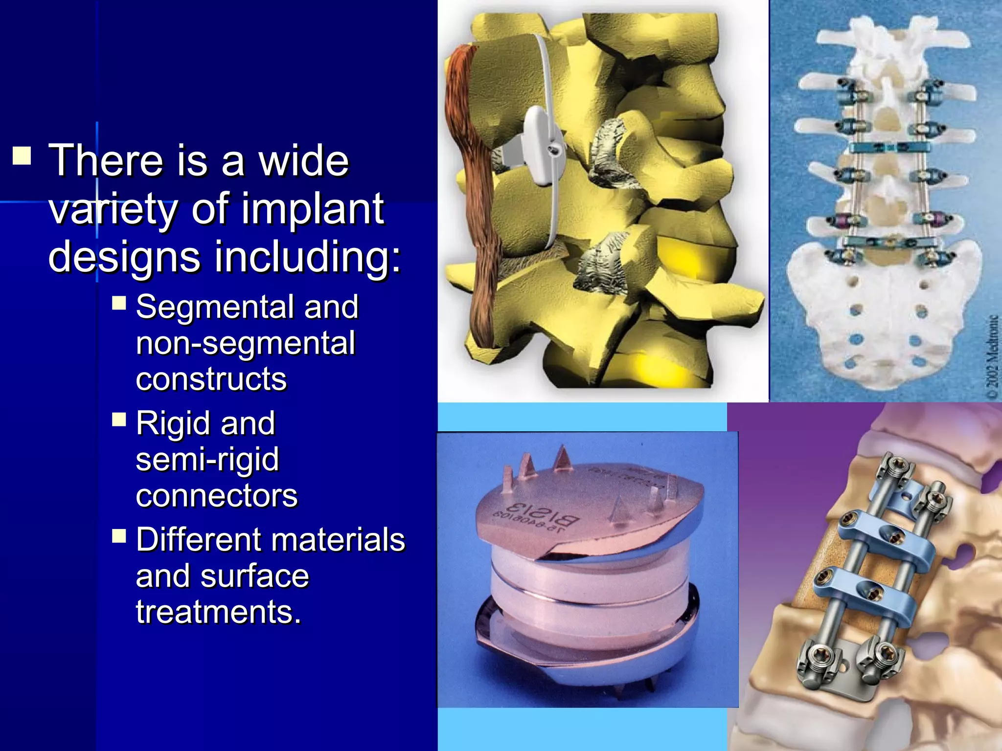 Late Post-operative Spinal Infections | PPT