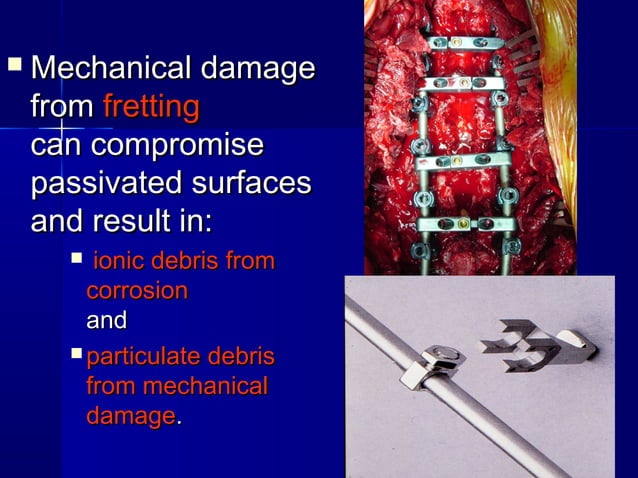 Late Post-operative Spinal Infections | PPT