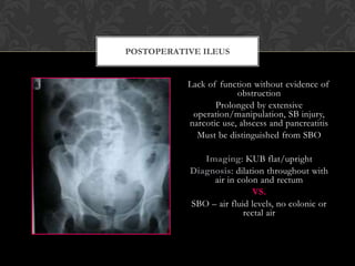Postoperative Surgical Complications.ppt