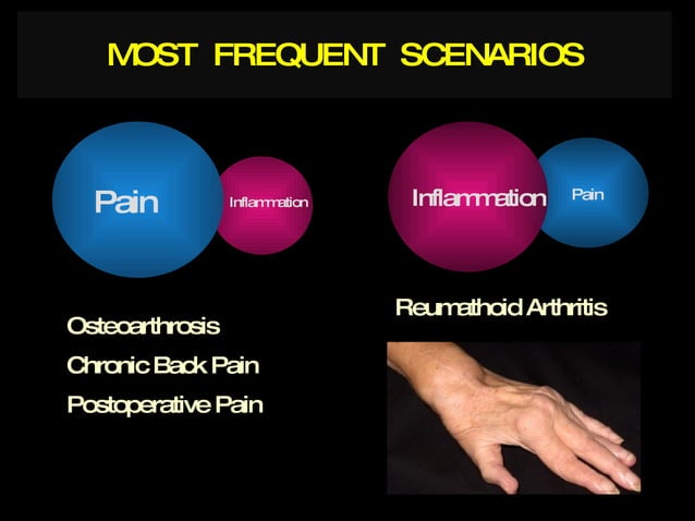 Postoperative Pain Management | PPT | Physical Therapy | Wellness