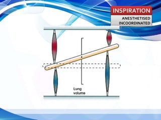 Postop pulmonary complications | PPSX