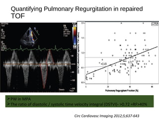 Post op tetrology of fallot (TOF) | PPT