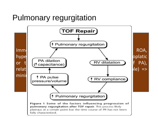 Post op tetrology of fallot (TOF) | PPT