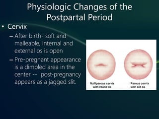 Postpartum | PPT