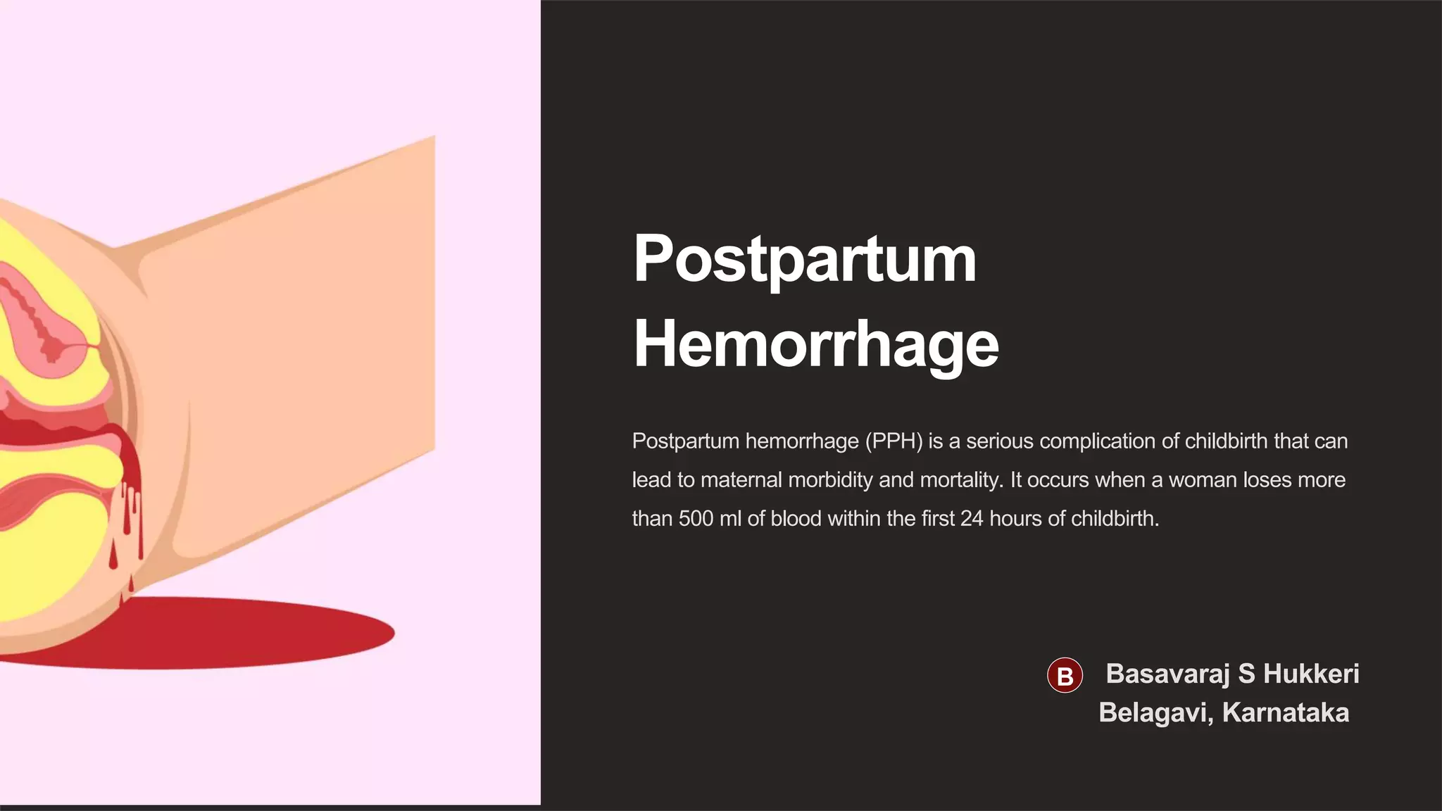 Postpartum-Hemorrhage.pptx