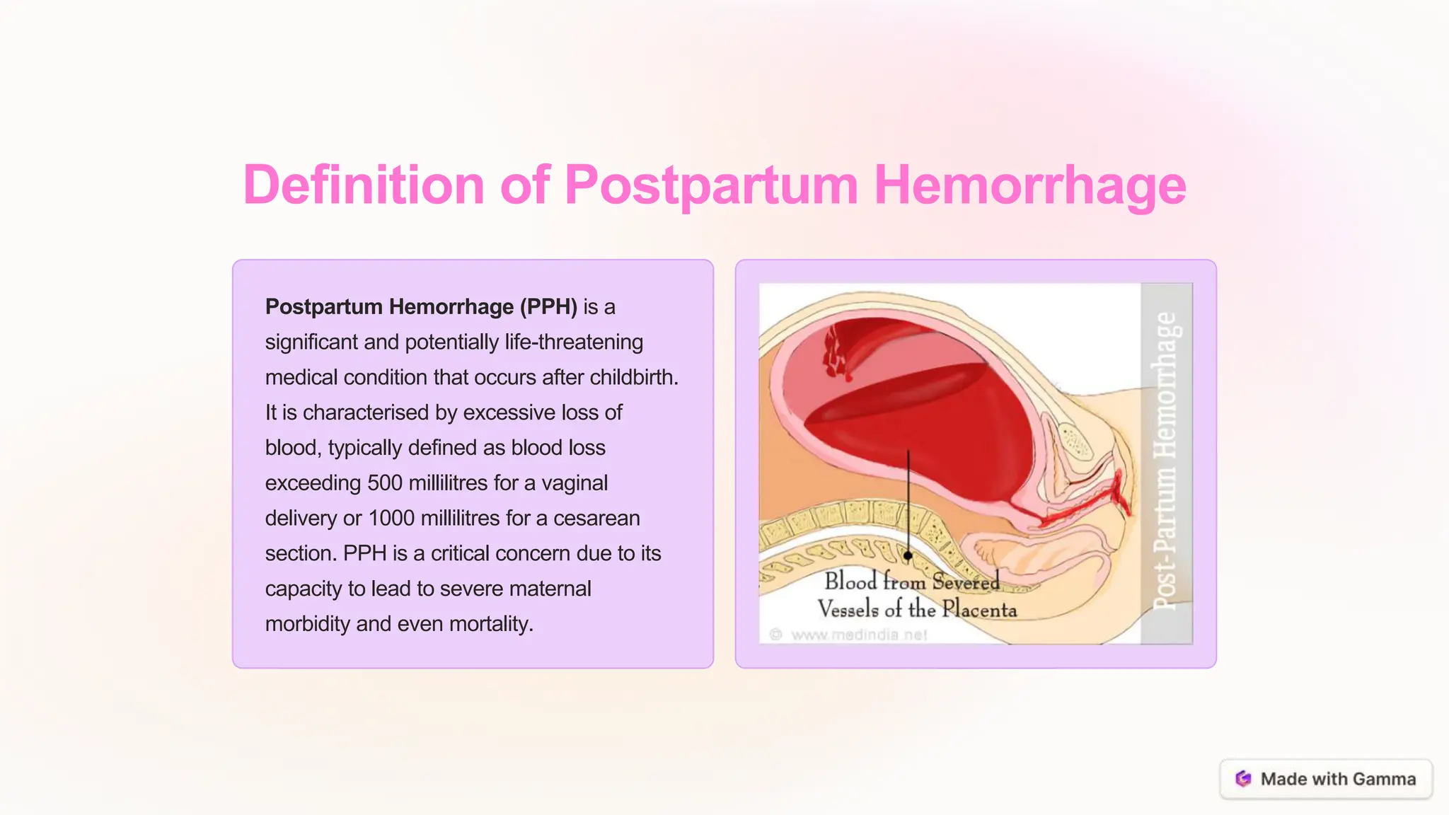 Postpartum-Hemorrhage.pptx