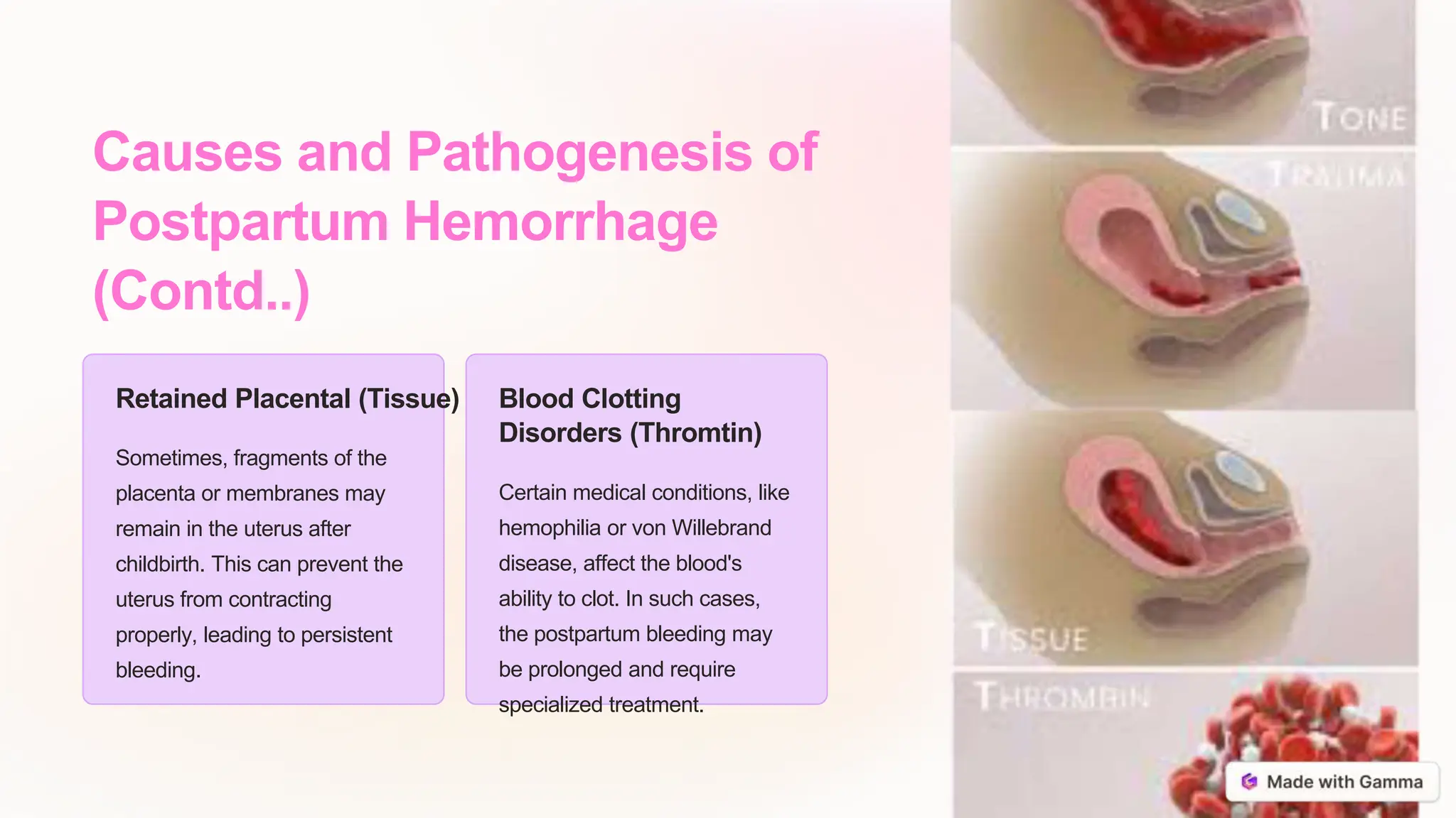 Postpartum Hemorrhage pptx