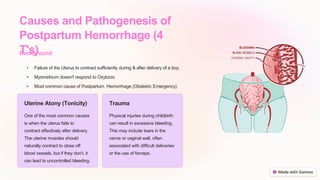 Postpartum-Hemorrhage.pptx