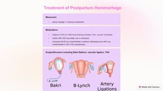 Postpartum-Hemorrhage.pptx
