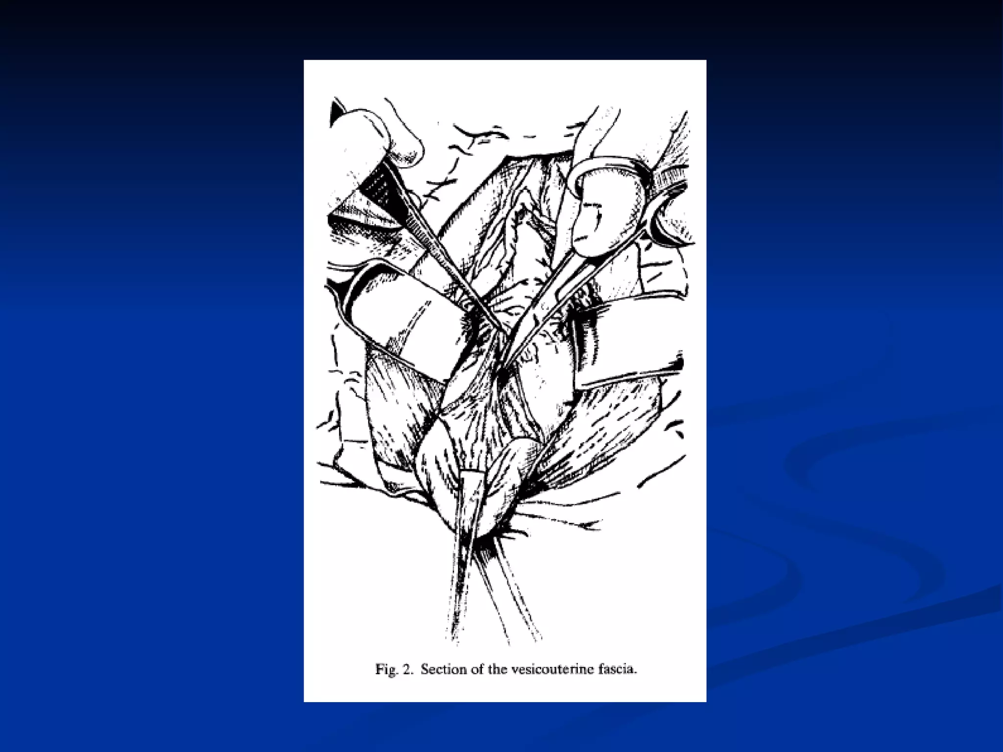 Postpartum Kanama - www.jinekolojivegebelik.com