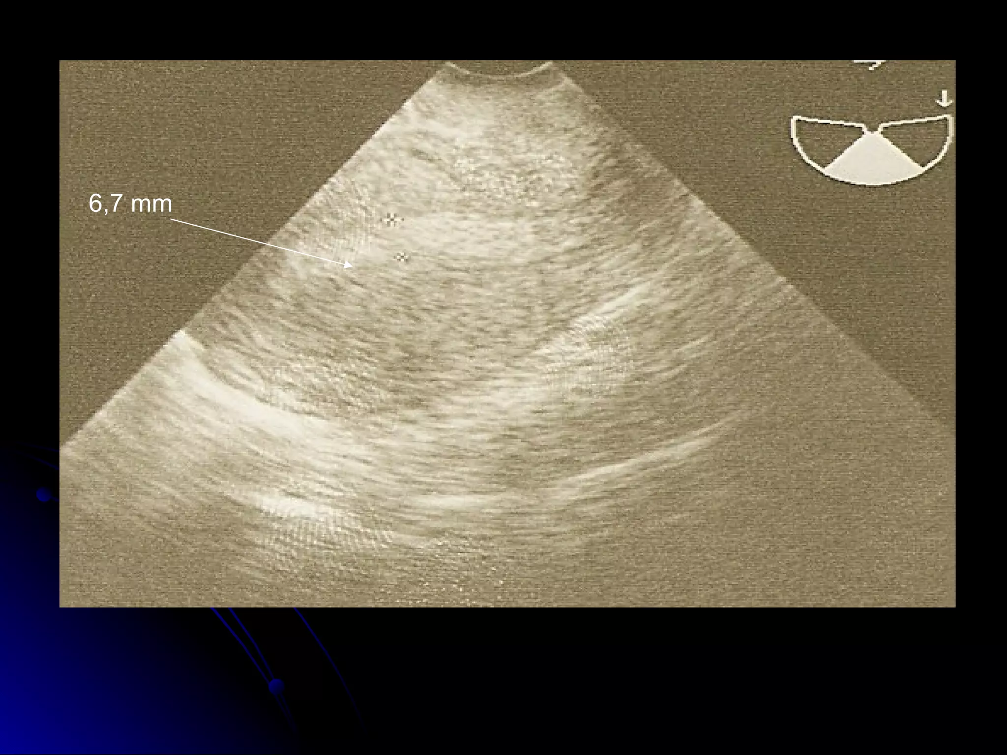 Postpartum Kanama - www.jinekolojivegebelik.com