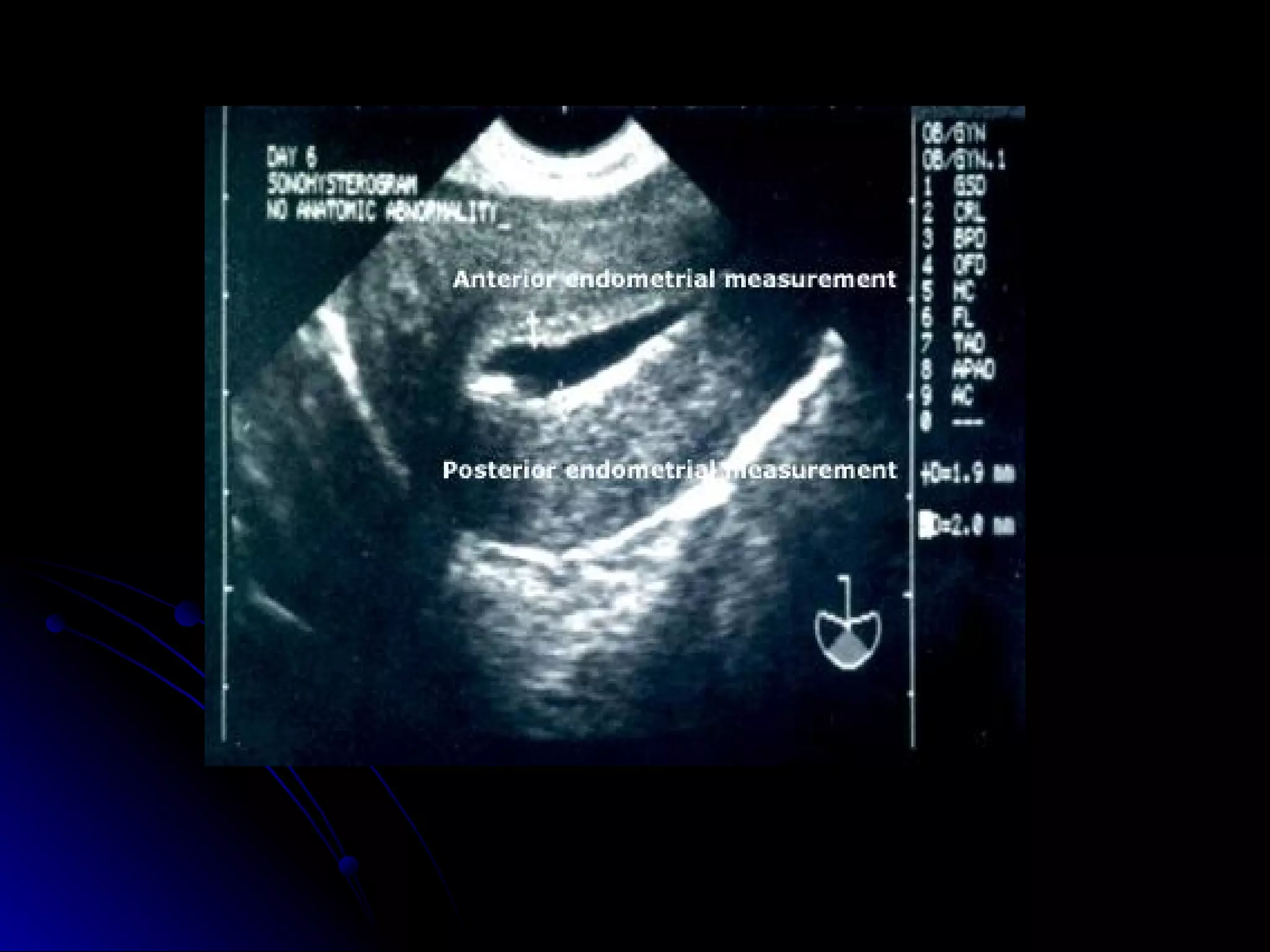 Postpartum Kanama - www.jinekolojivegebelik.com