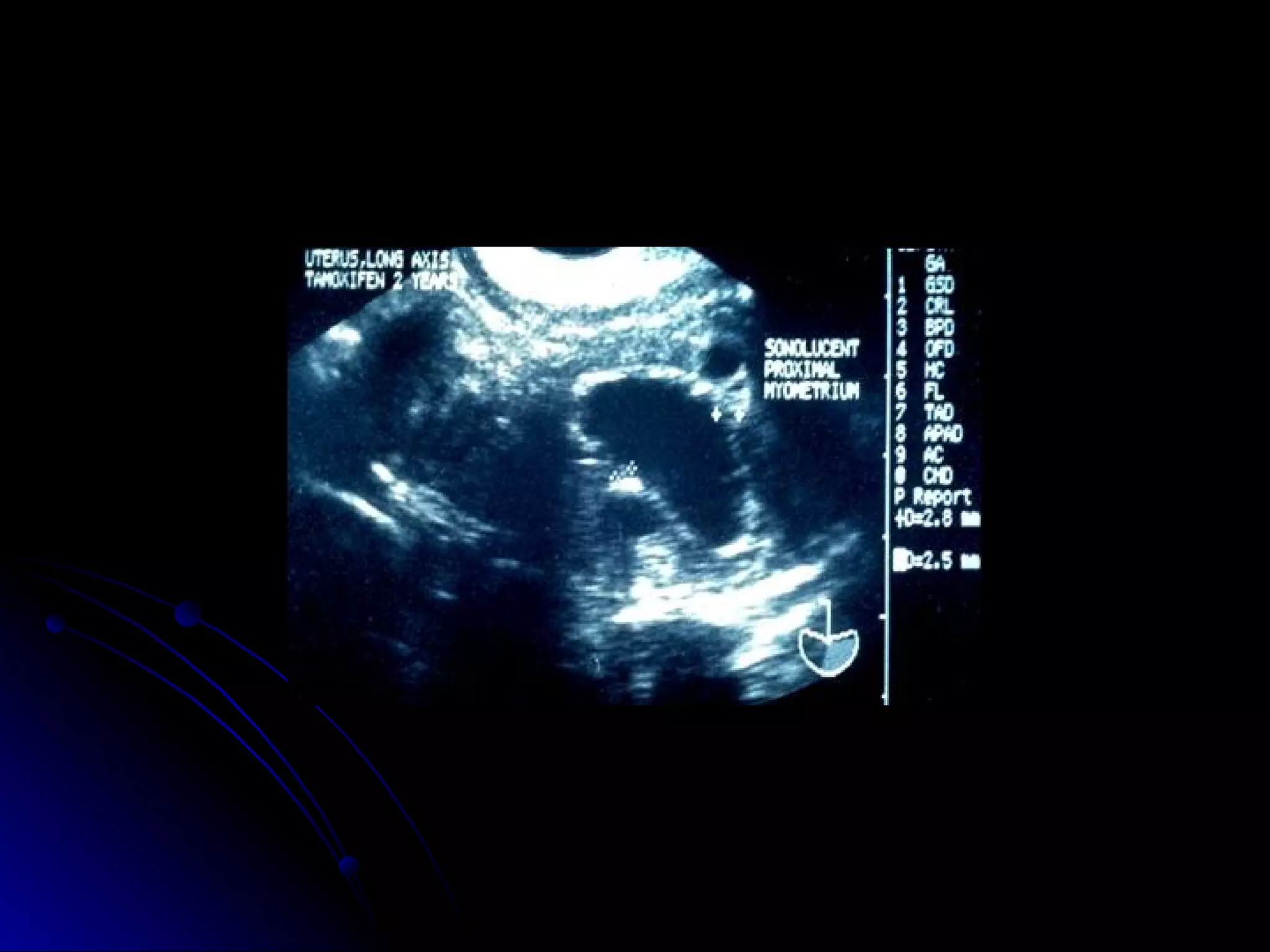 Postpartum Kanama - www.jinekolojivegebelik.com