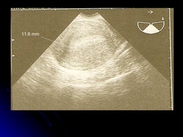 Postpartum Kanama - www.jinekolojivegebelik.com