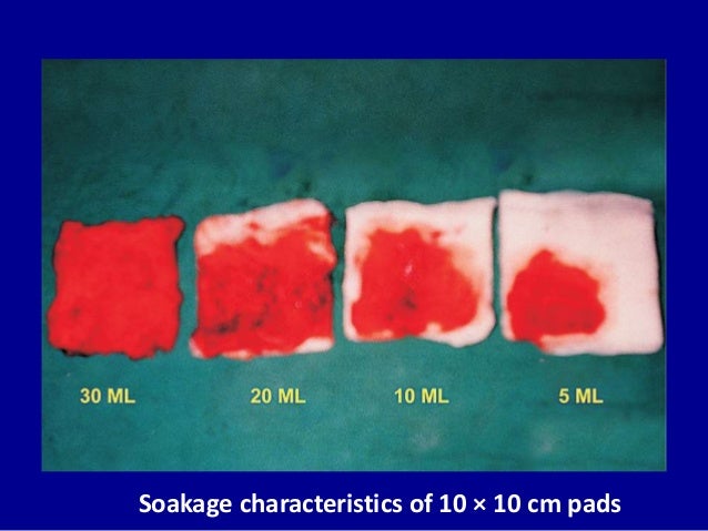 Postpartum haemorrahge final