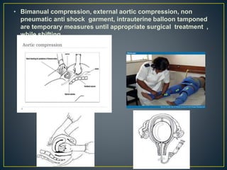 Post partum haemorrhage | PPTX