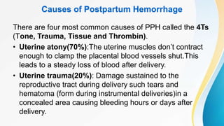 POSTPARTUM HAEMORRHAGE.pptx