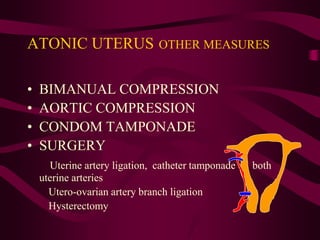 post partum haemorrhage.ppt how to access | PPT