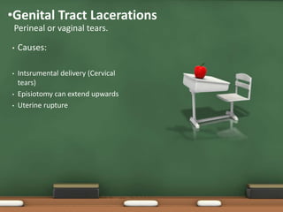 Postpartum haemorrhage (pph) | PPTX