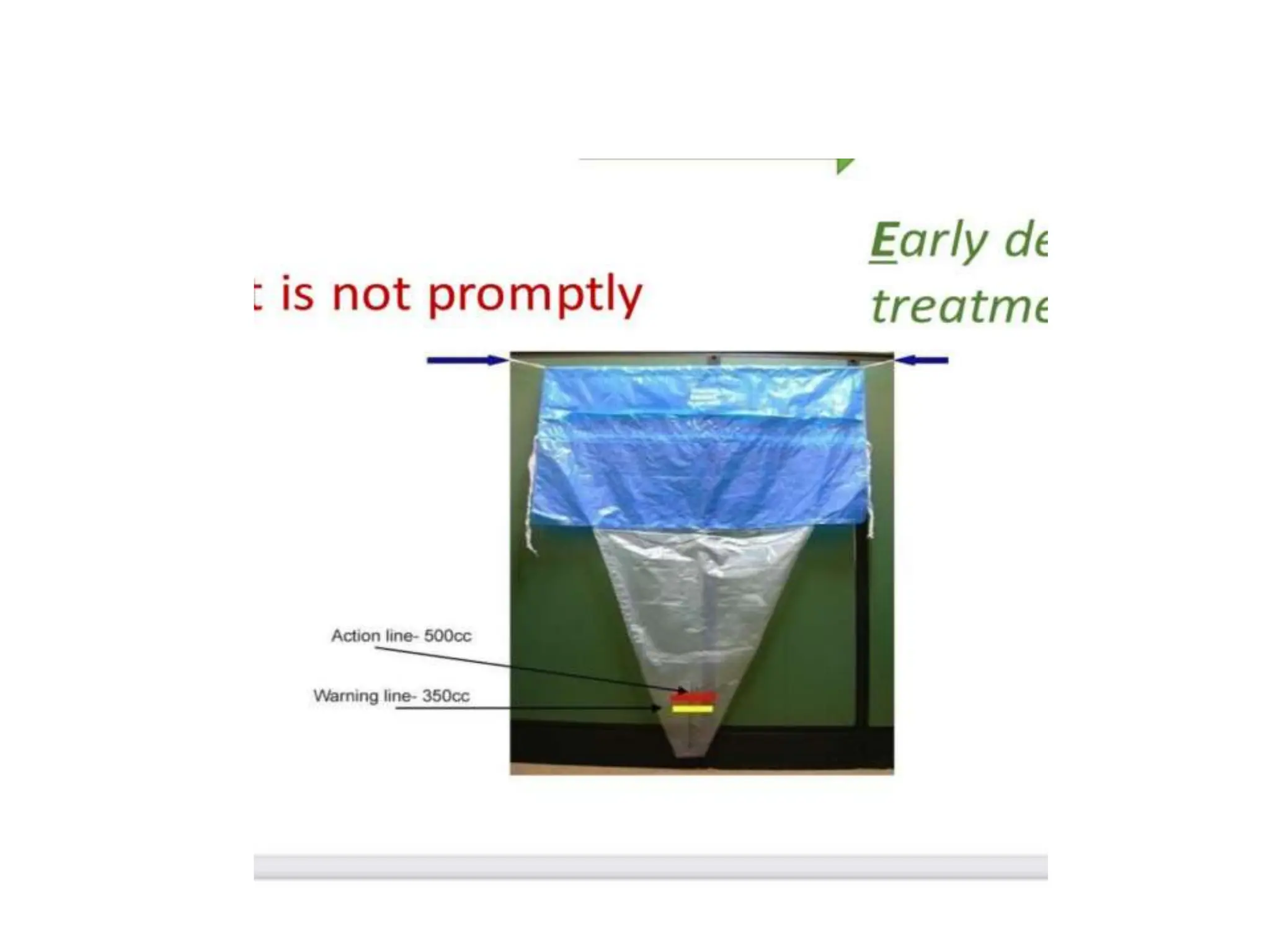POST PARTUM HAEMORRHAGE (PPH).pptx