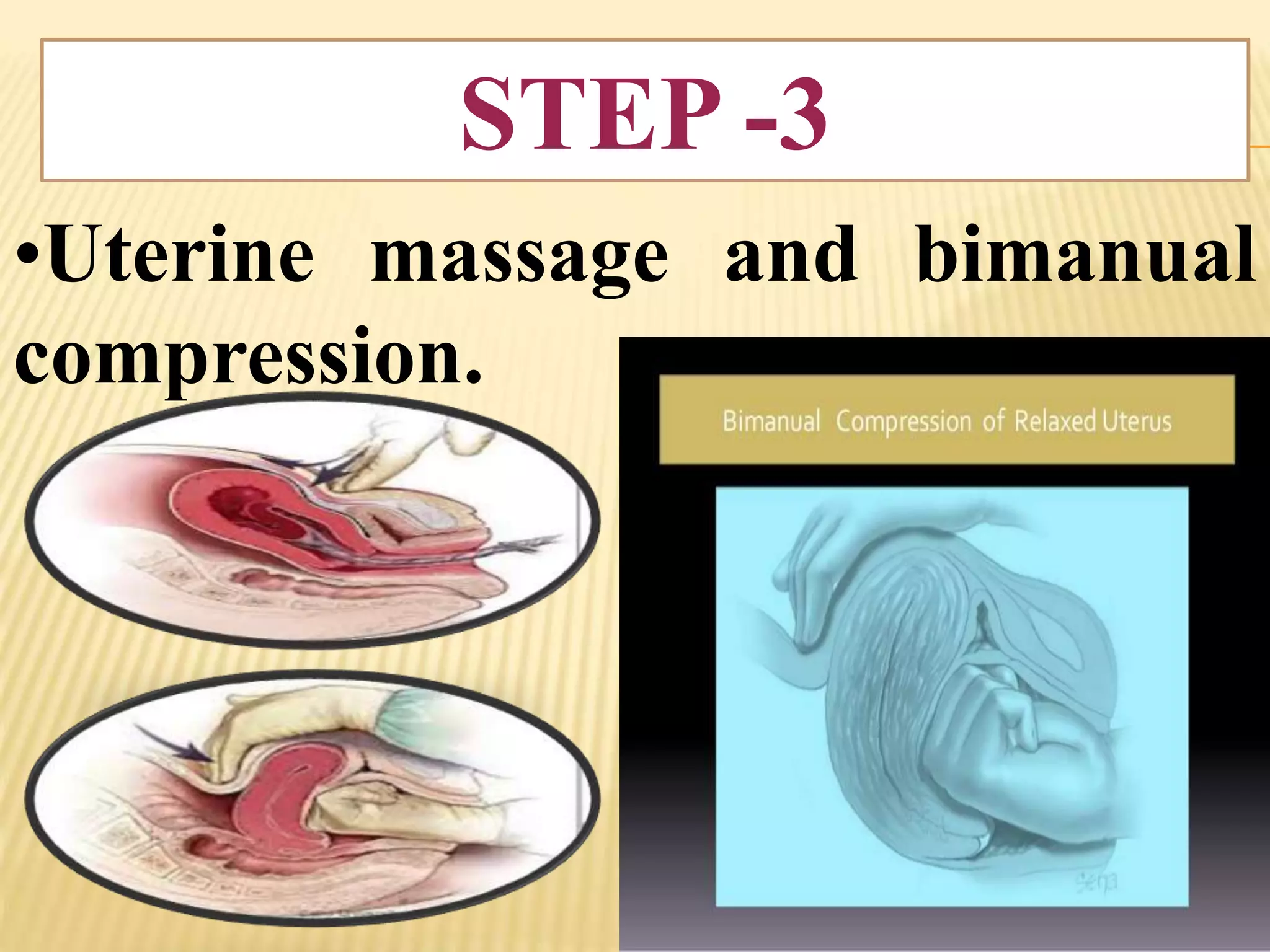 POST PARTUM HAEMORRHOEGE PPT.pptx