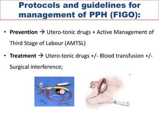 Postpartum hemorrhage | PPT