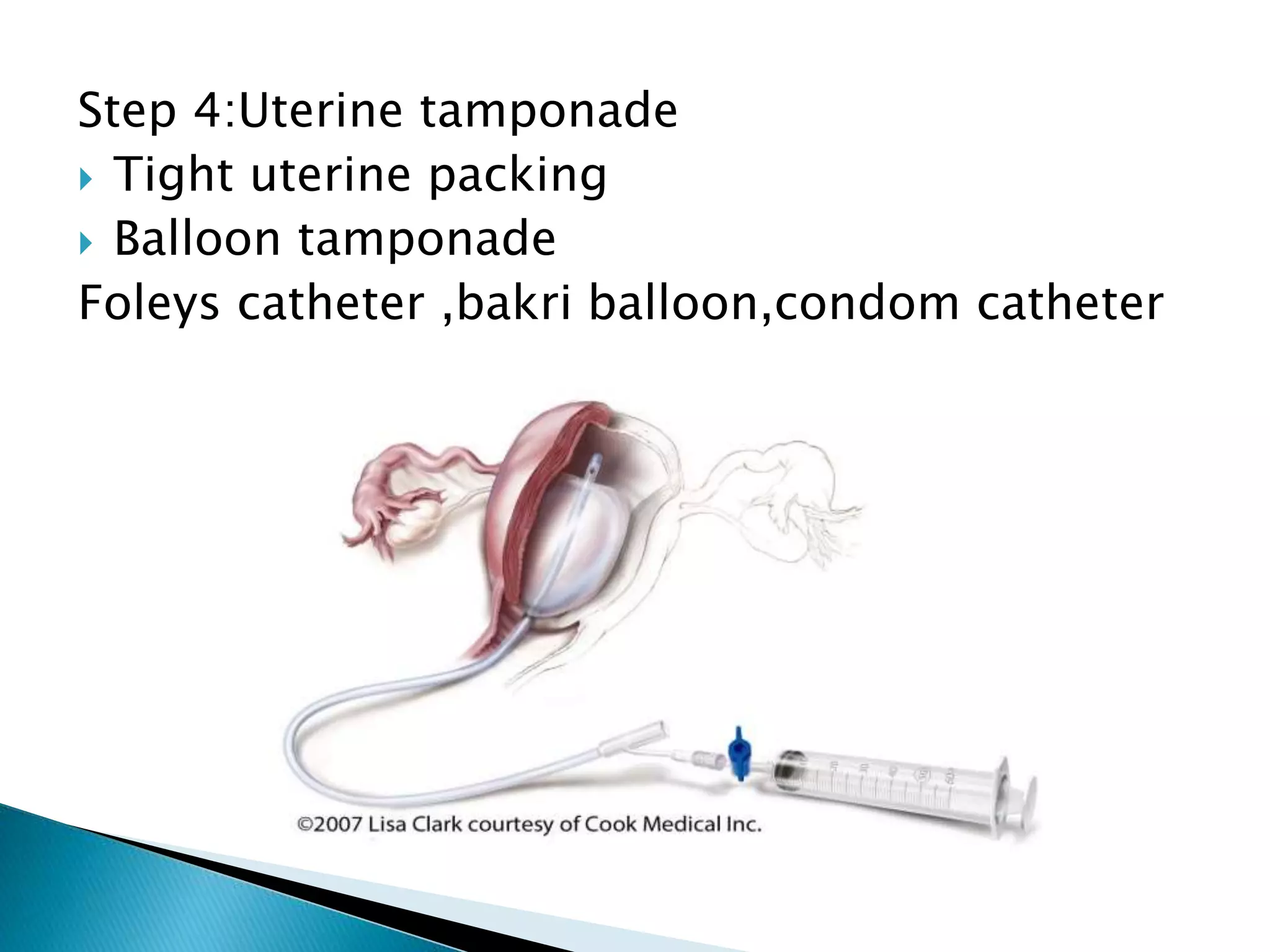 POSTPARTUM HEMORRHAGE.pptx