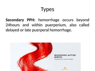 Postpartum Hemorrhage.pptx.TYPES OF PPH AND MANAGEMENT | PPTX