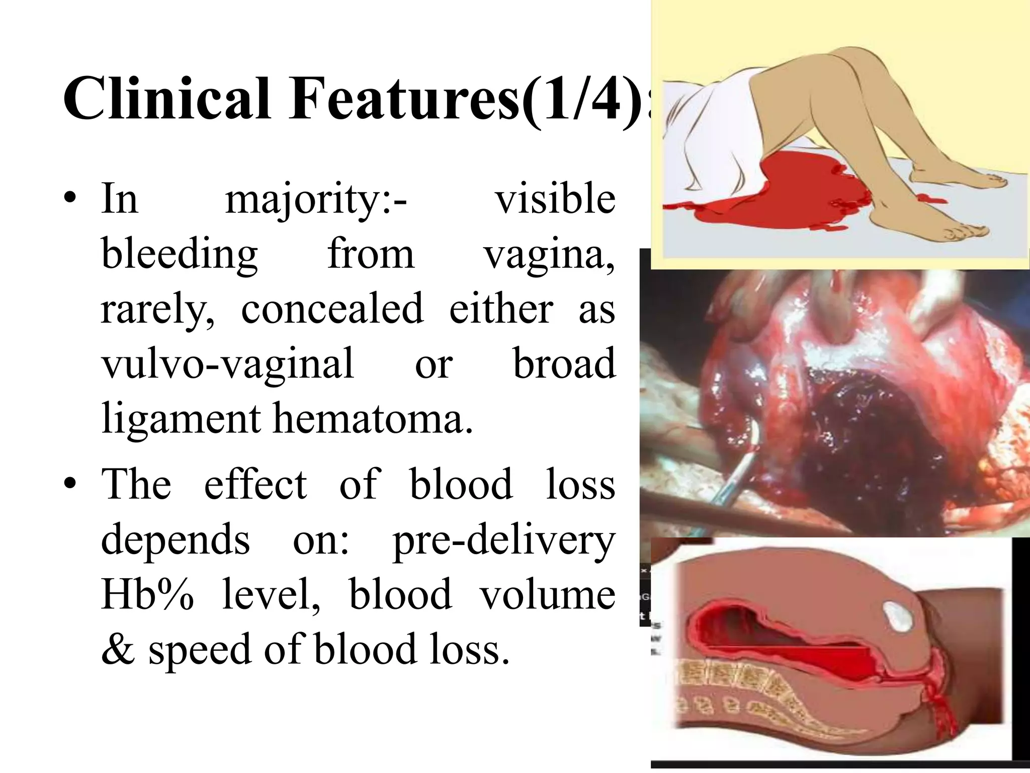 Postpartum hemorrhage - with pictures.pptx