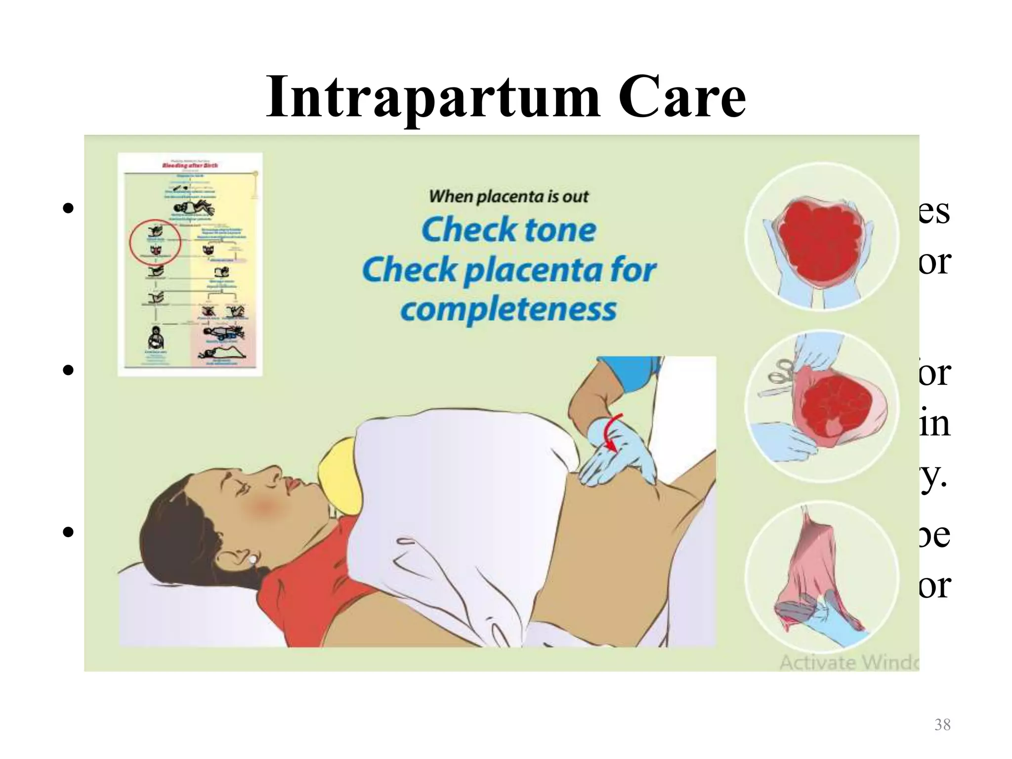 Postpartum hemorrhage - with pictures.pptx