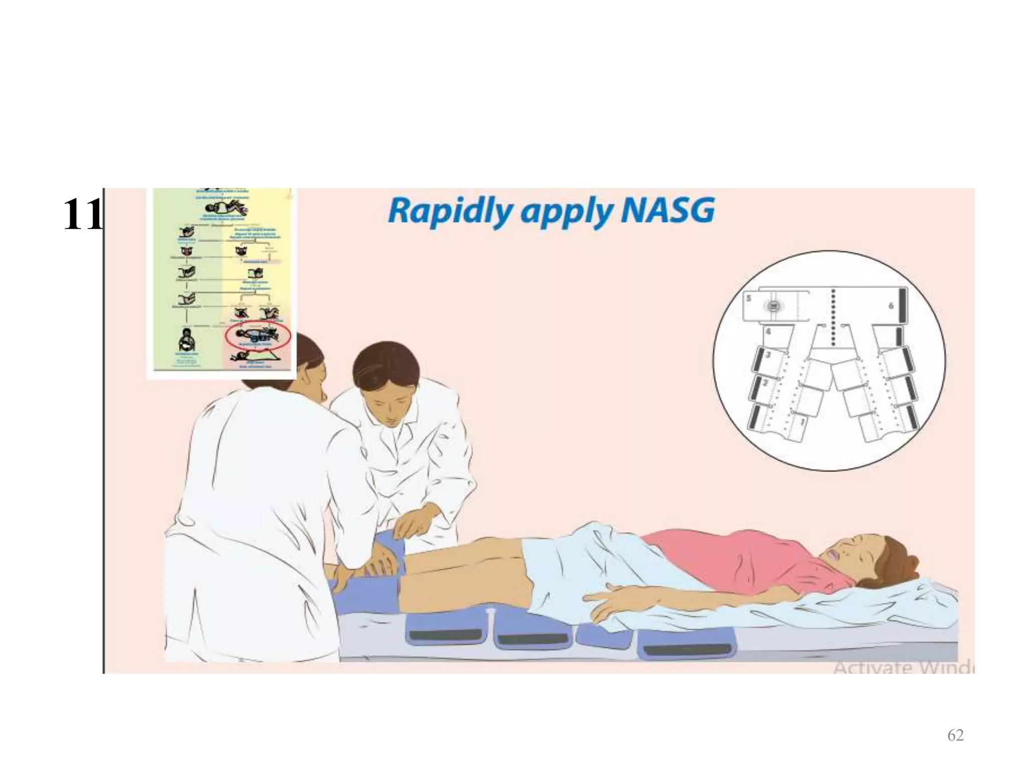 Postpartum hemorrhage - with pictures.pptx