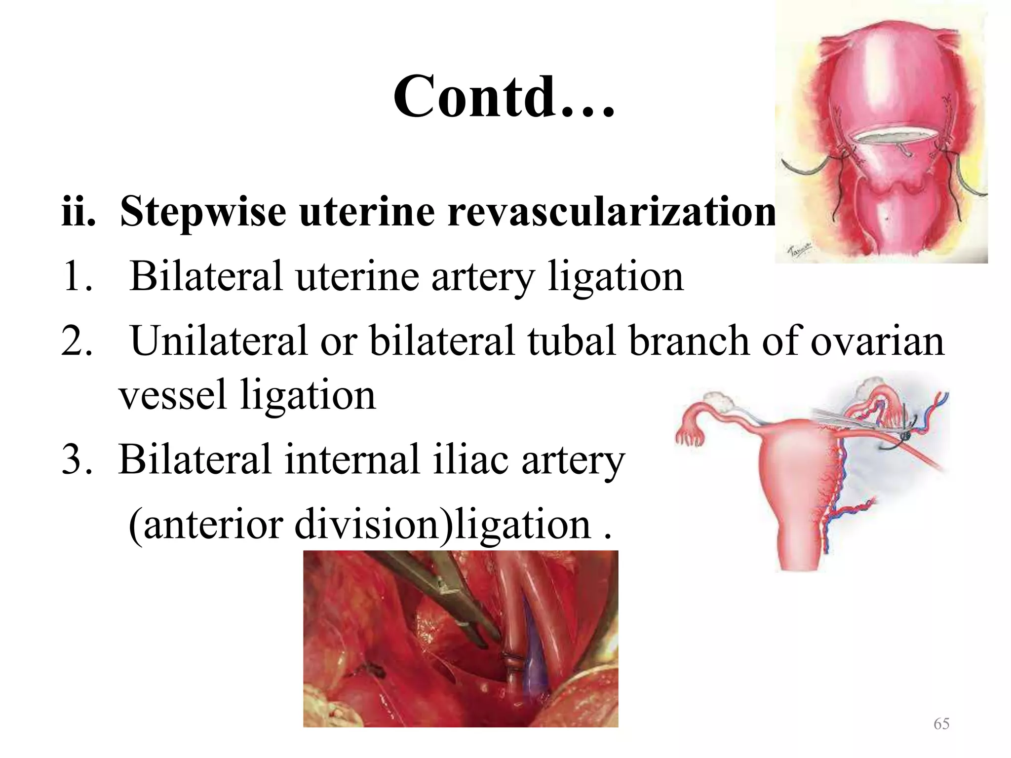 Postpartum hemorrhage - with pictures.pptx