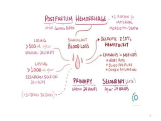 Postpartum Hemorrhage Concept Map