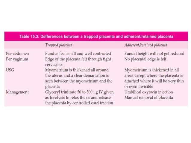 Post Partum Hemorrhage (PPH).ppt | Pregnancy | Reproductive Health