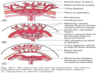 Post Partum Hemorrhage (PPH).ppt