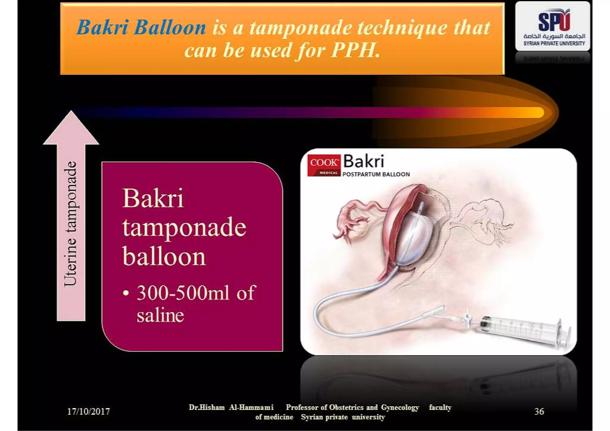 Postpartum hemorrhage (pph) dr hisham al hammami 17 10 2017 health ...