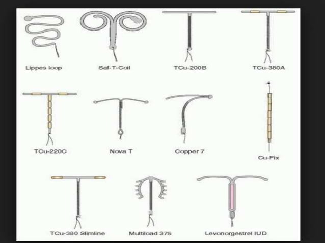 Post partum iud insertion | PPTX | Pregnancy | Reproductive Health