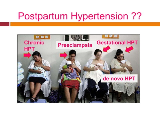 Postpartum management of hypertensive disorders in pregnancy | PPT