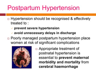 Postpartum management of hypertensive disorders in pregnancy | PPTX