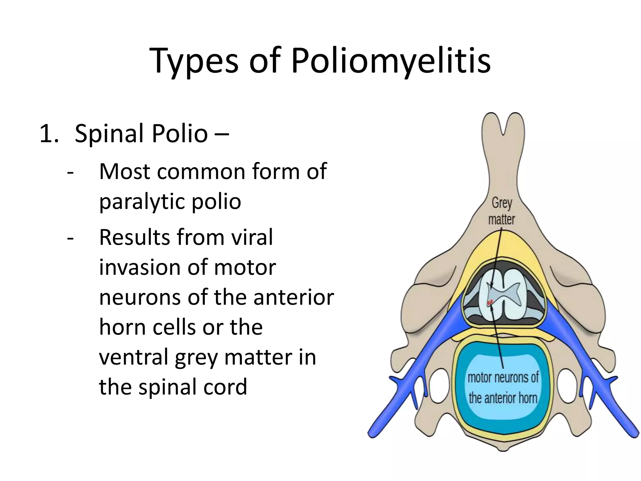 Post Polio Residual Paralysis | PPTX