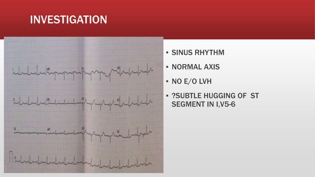 POST PRANDIAL ANGINA WITH DOUBLE VESSEL DISEASE ,TOTAL OCCLUSION OF ...