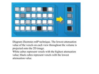 Post Processing of CT Thorax | PPTX