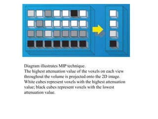 Post Processing of CT Thorax | PPTX