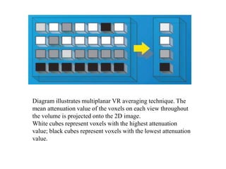 Post Processing of CT Thorax | PPTX