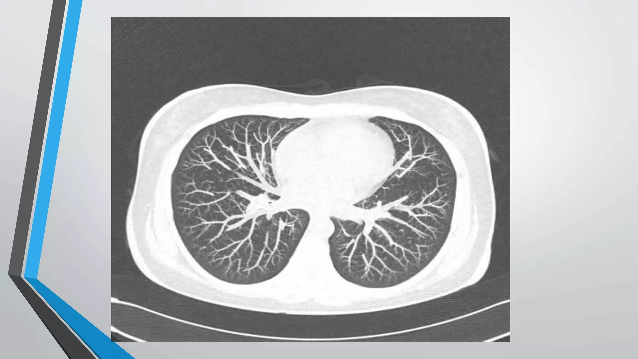 Post processing of computed tomography | PPTX
